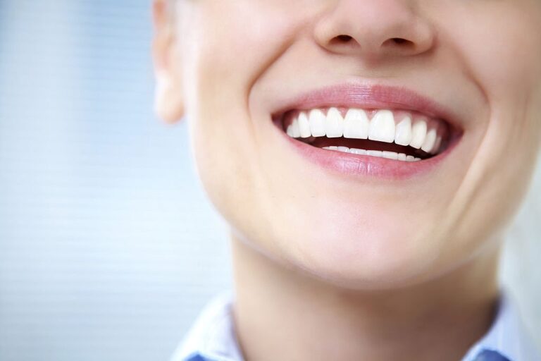 Everything You Need to Know About Professional Teeth Whitening ...